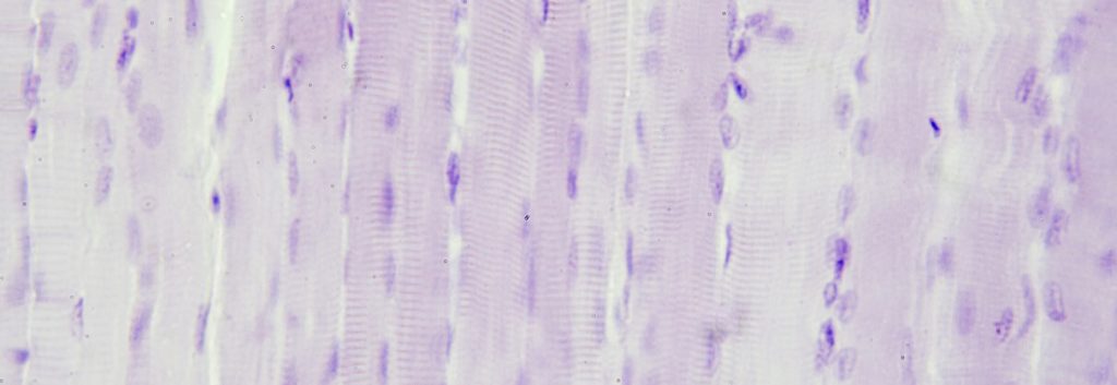 FDA Fast Tracks Muscular Dystrophy Drug backed by Woodford