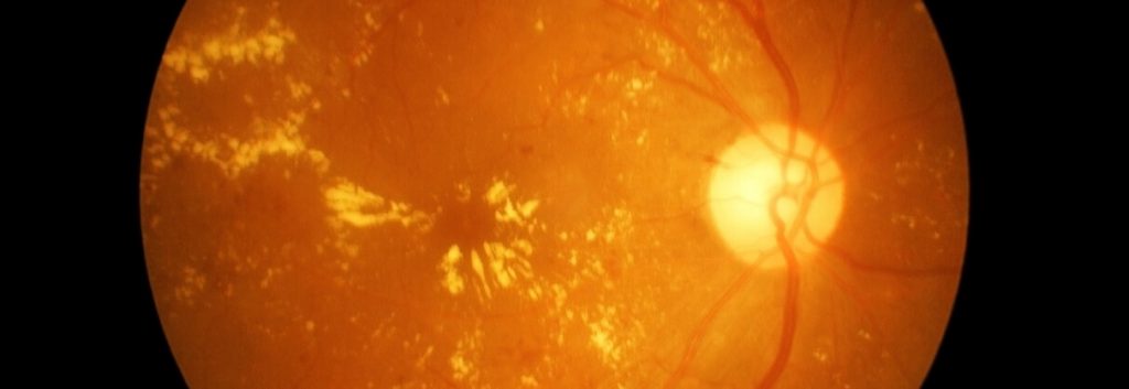 Novartis Tops Ophthalmology Blockbuster Eylea in Phase III Trials