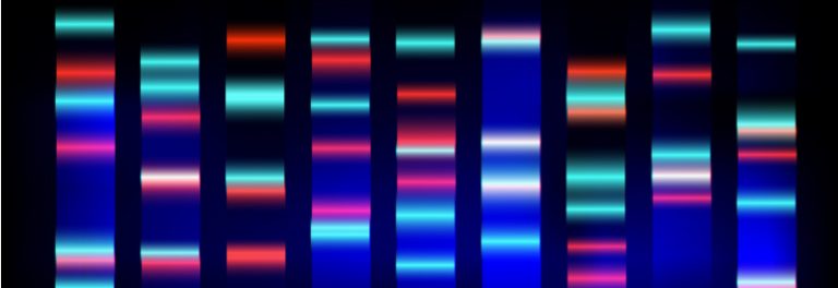 Using Molecular Combing for the Discovery of Genetic Diseases