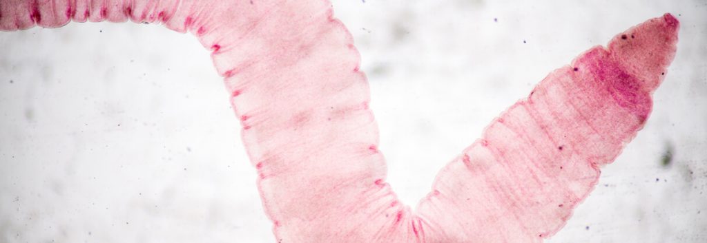 Anti-Parasitic May Help to Treat Prostate Cancer, Say Norwegian Scientists