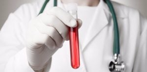 Roche Partners with French Startup Inotrem to Diagnose Septic Shock