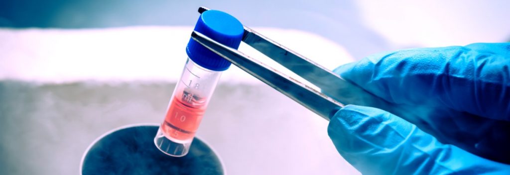 Alofisel, a Stem Cell Therapy for Crohn's Disease, Approved in Europe