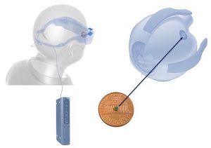 Top Medical Device Companies Innovating in Europe