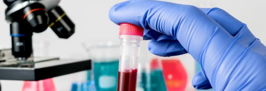 TC Biopharm Boosts its CAR-T Pipeline for Cancer and HIV