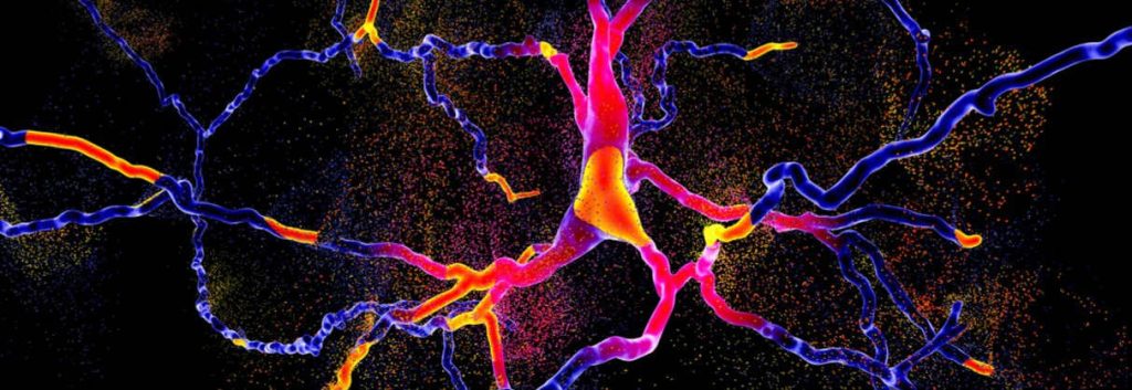 Axovant's Parkinson's Disease Gene Therapy Clinical Trial Launched in UK