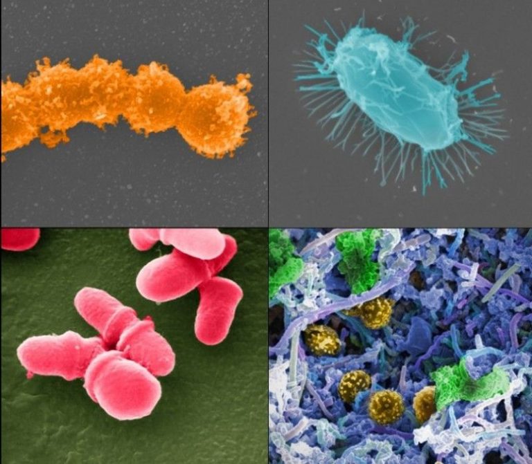 Tackling the Complexity of the Gut Microbiome for Better Treatments