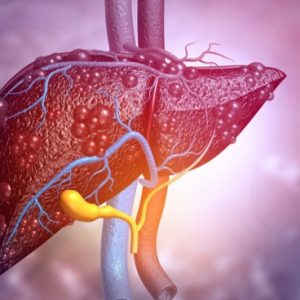 Promethera Raises €47M to Fund NASH Clinical Trial