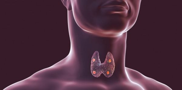 Amolyt Pharma publishes hypoparathyroidism treatment results