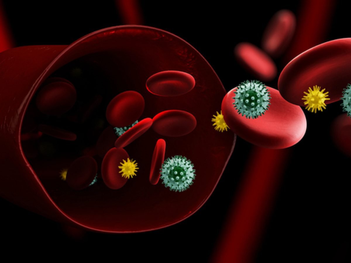 Blood Infection Sepsis Blood Infection Blood Infection