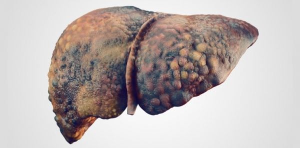 HepaRegeniX Raises €11M to Regenerate Liver Damage