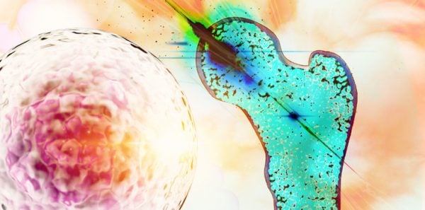 Gamida Cell’s Bone Marrow Transplant Cuts Treatment Time in Phase III