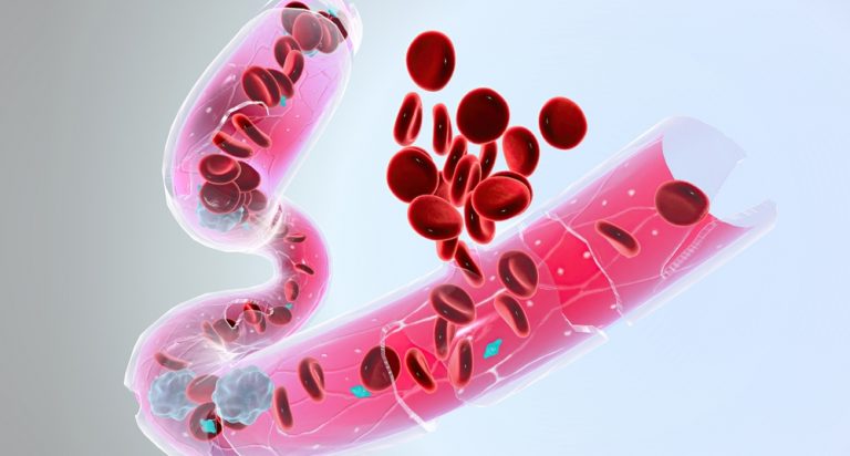 Sanofi hemophilia drug ALTUVIIIO gets FDA approval