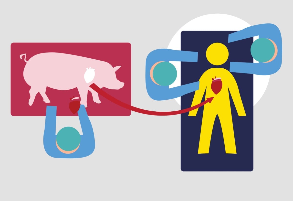 Xenotransplantation: solving the transplant shortage crisis